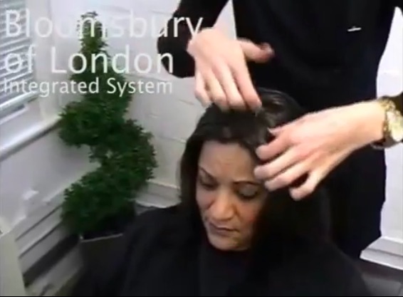 BioGraft Hair Restoration | Hair Restoration | Bloomsbury